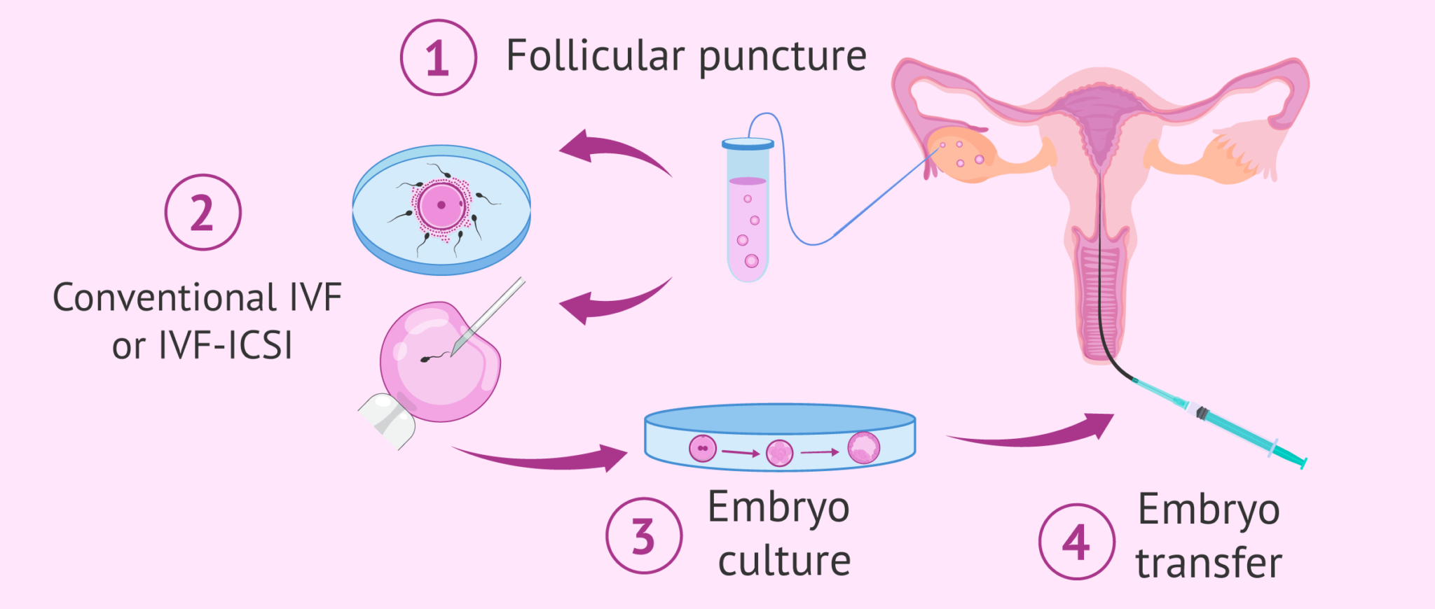 In Vitro Fertilization I IQRAA Fertility